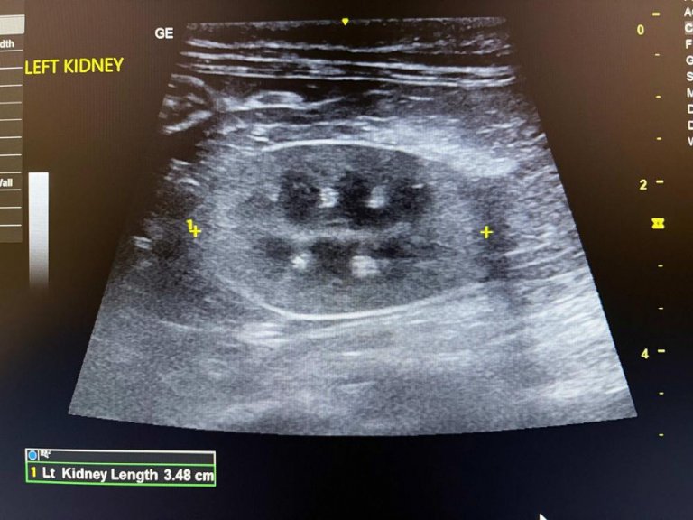 Ultrasound for Cats: Costs & Procedure Explained - Cats.com